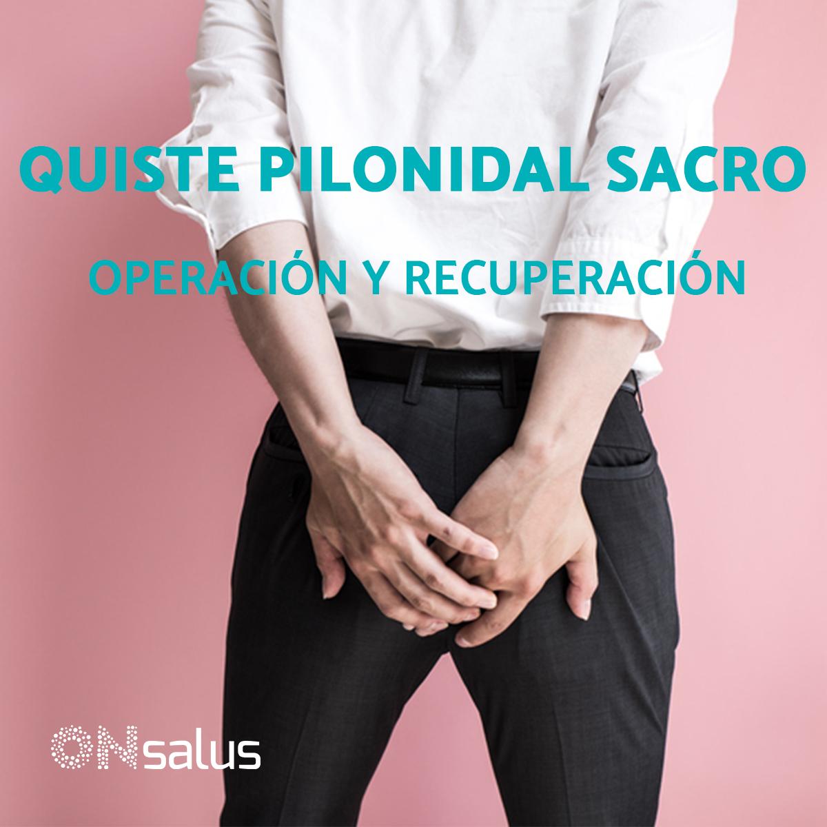 Recuperación de la operación de quiste pilonidal o sacro