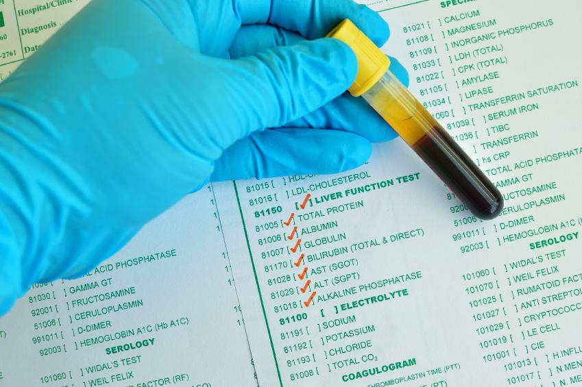 Colestasis: síntomas, tratamiento y consecuencias