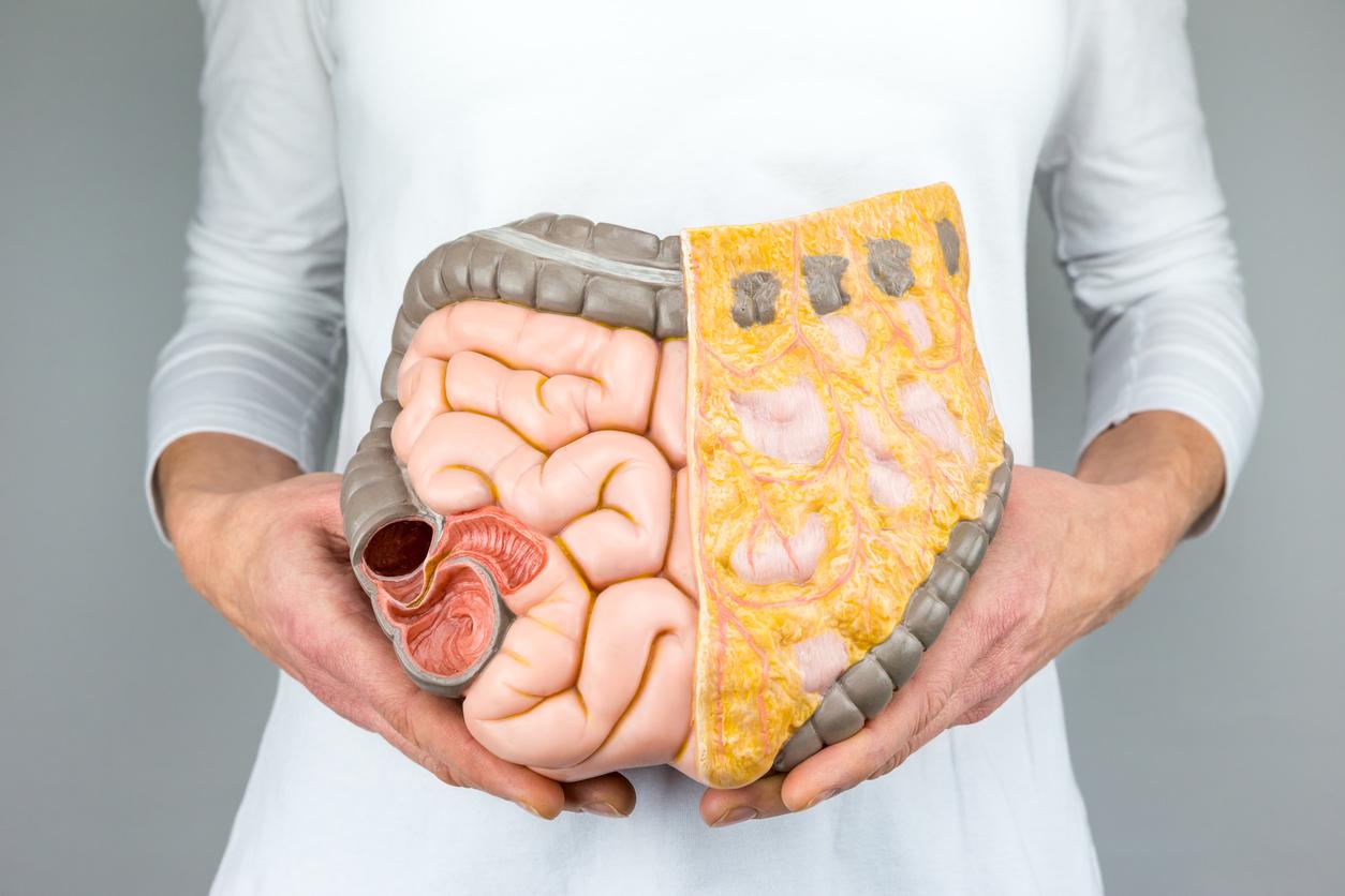 Colitis nerviosa: causas, síntomas y tratamiento