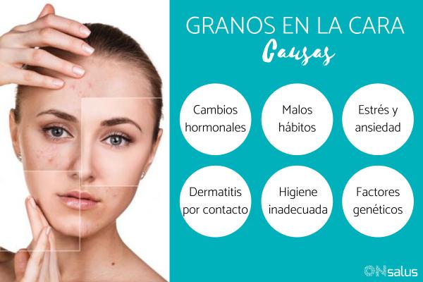 Granos en la cara: causas y remedios caseros (2022) Granos en la cara: causas y remedios caseros (2022)