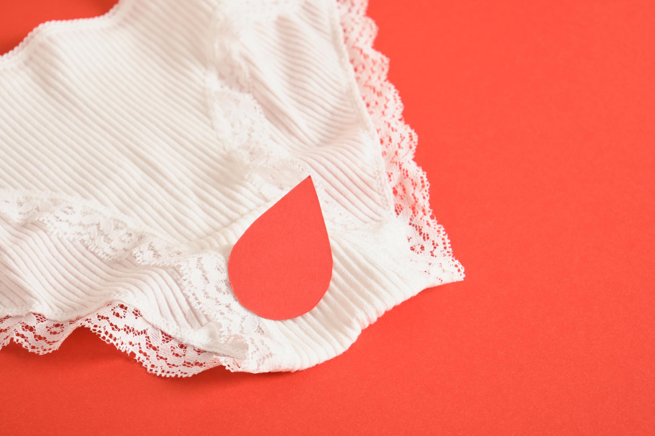 ¿Es normal el sangrado vaginal si tienes hongos?